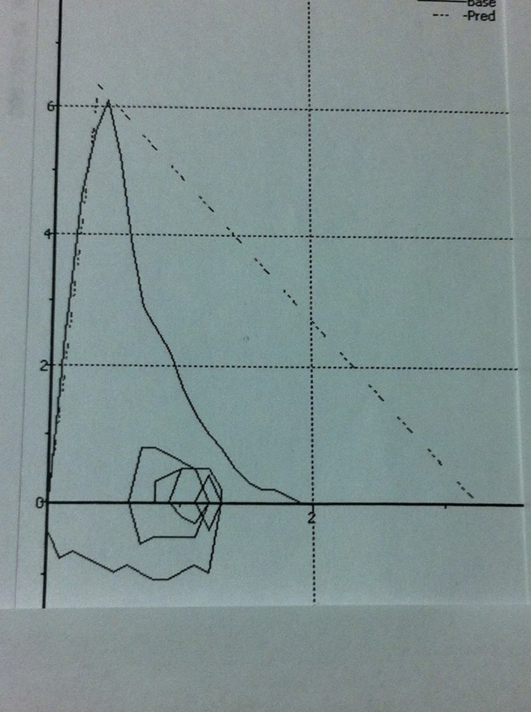 Interpreting lung function tests - Amy and Pals